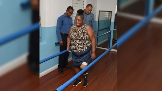 68 Amputees To Receive Prosthetic Limbs | RJR News - Jamaican News Online